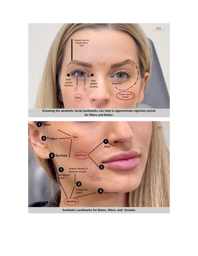 Basic Botox Training Program | V-Line Aesthetics
