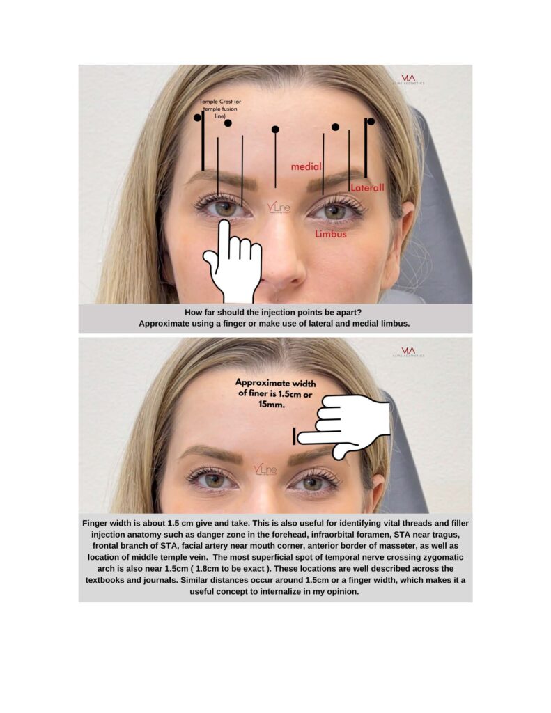 Basic Botox Training Program | V-Line Aesthetics