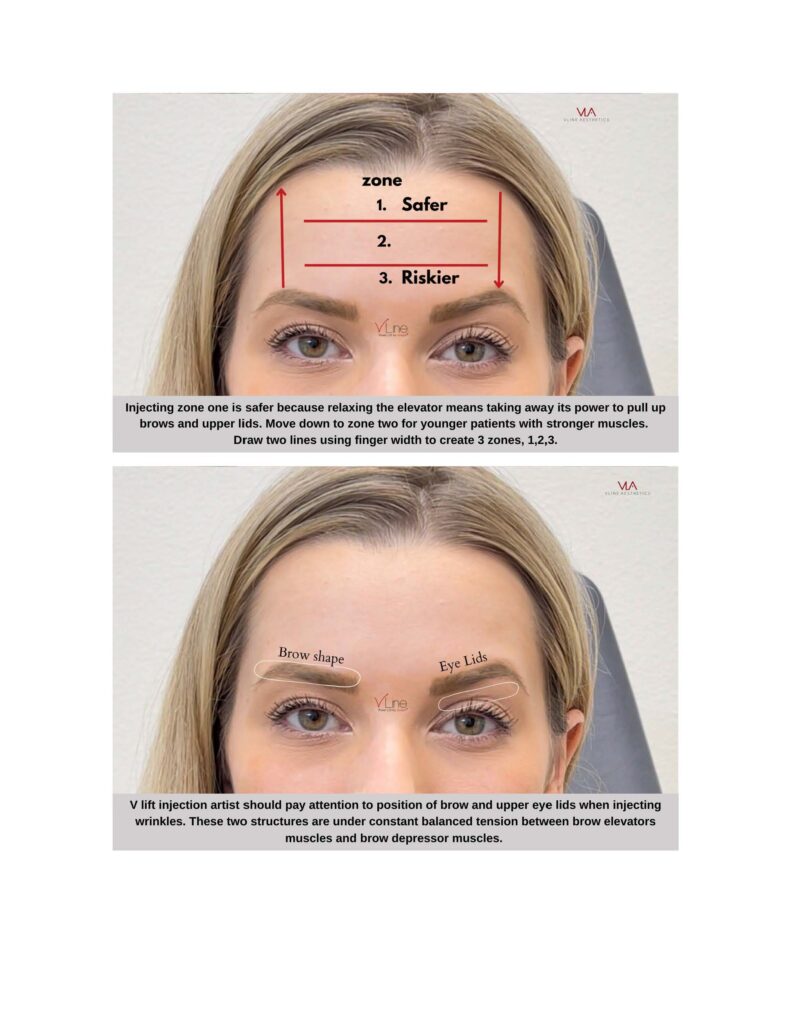 Basic Botox Training Program | V-Line Aesthetics