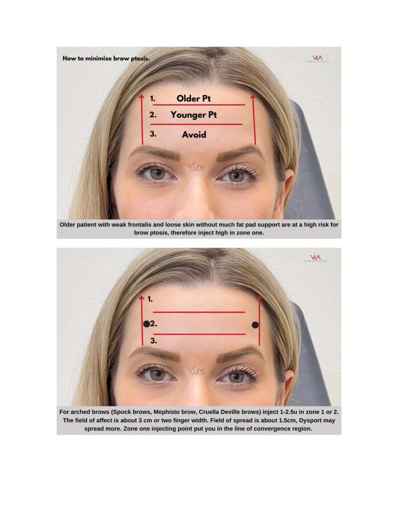 Basic Botox Training Program | V-Line Aesthetics