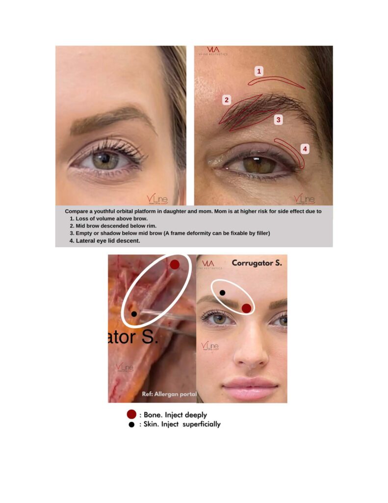 Basic Botox Training Program | V-Line Aesthetics
