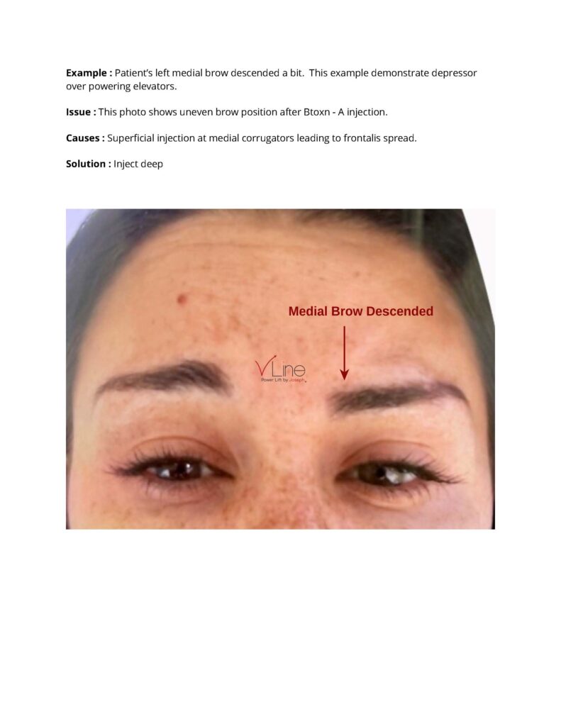 Basic Botox Training Program | V-Line Aesthetics