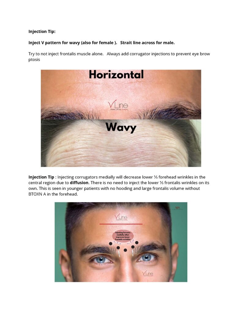 Basic Botox Training Program | V-Line Aesthetics