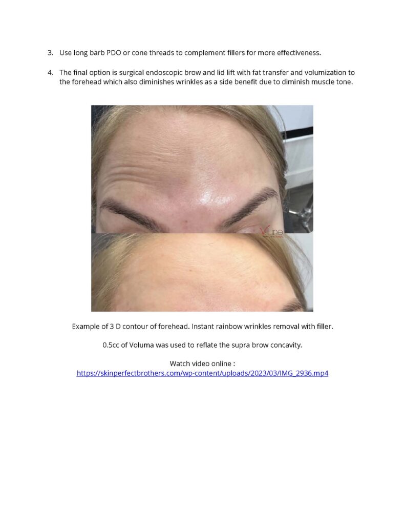 Basic Botox Training Program | V-Line Aesthetics