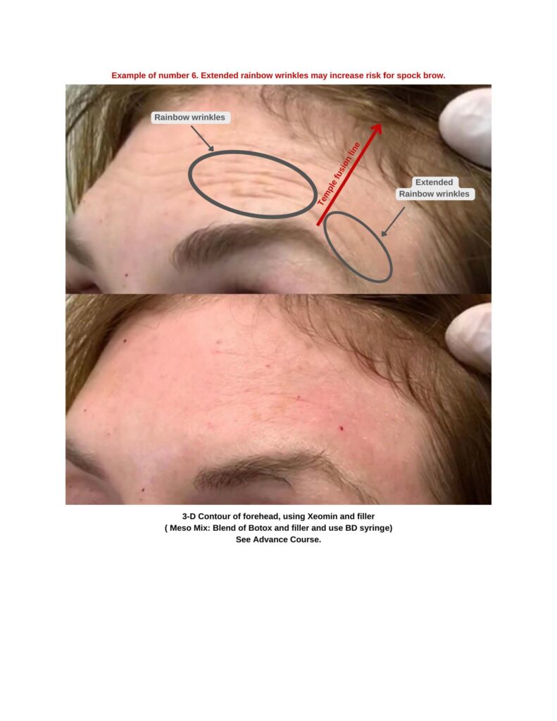 Basic Botox Training Program | V-Line Aesthetics