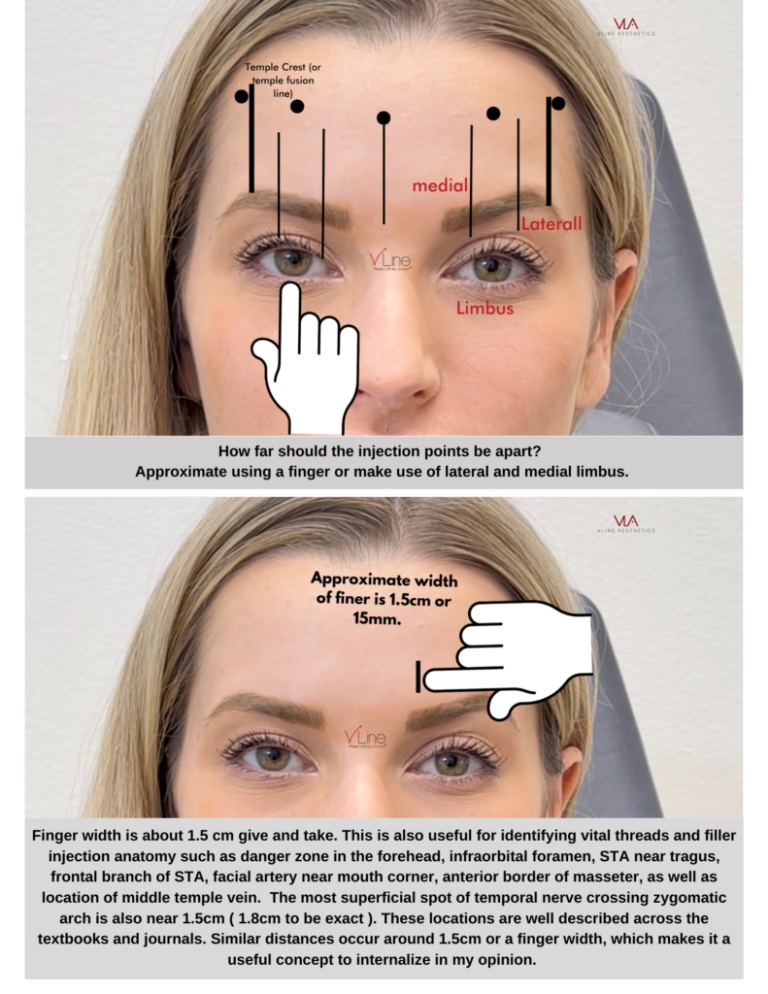 Botox Training Program - Basic | V-Line Aesthetics