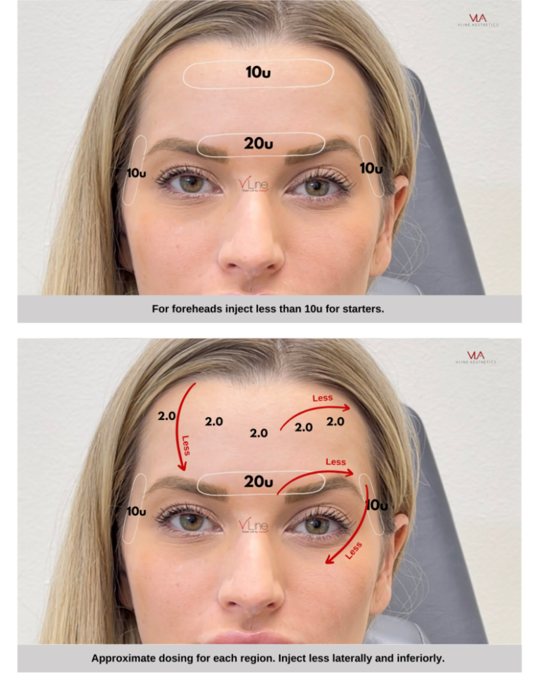 Botox Training Program - Basic | V-Line Aesthetics